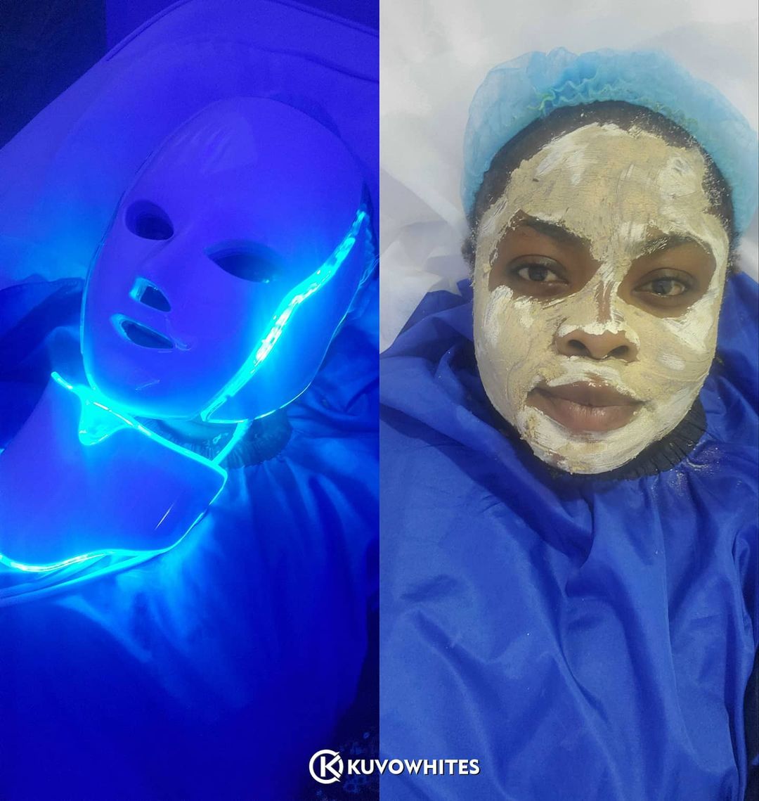 Kuvowhites || Medical health, Aesthetics & Spa services